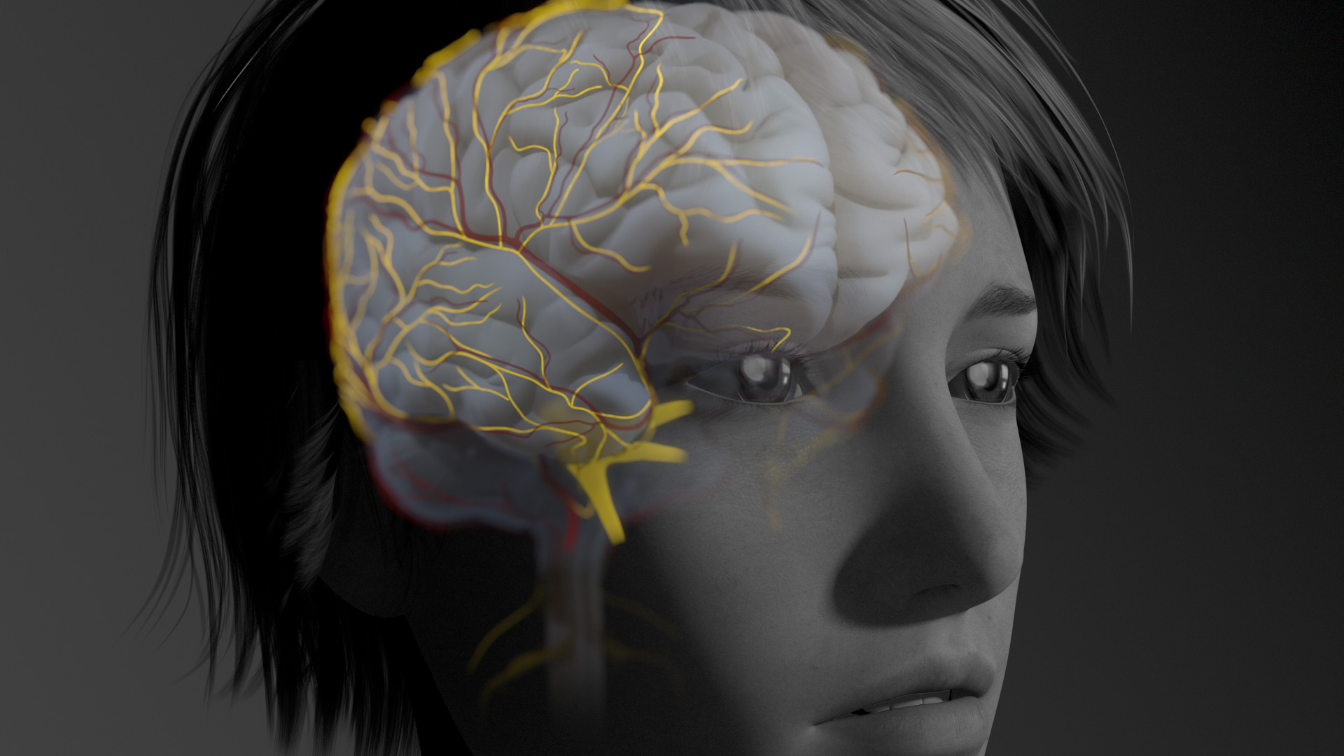 Medical Animation: CGRP in Migraine | AXS Studio