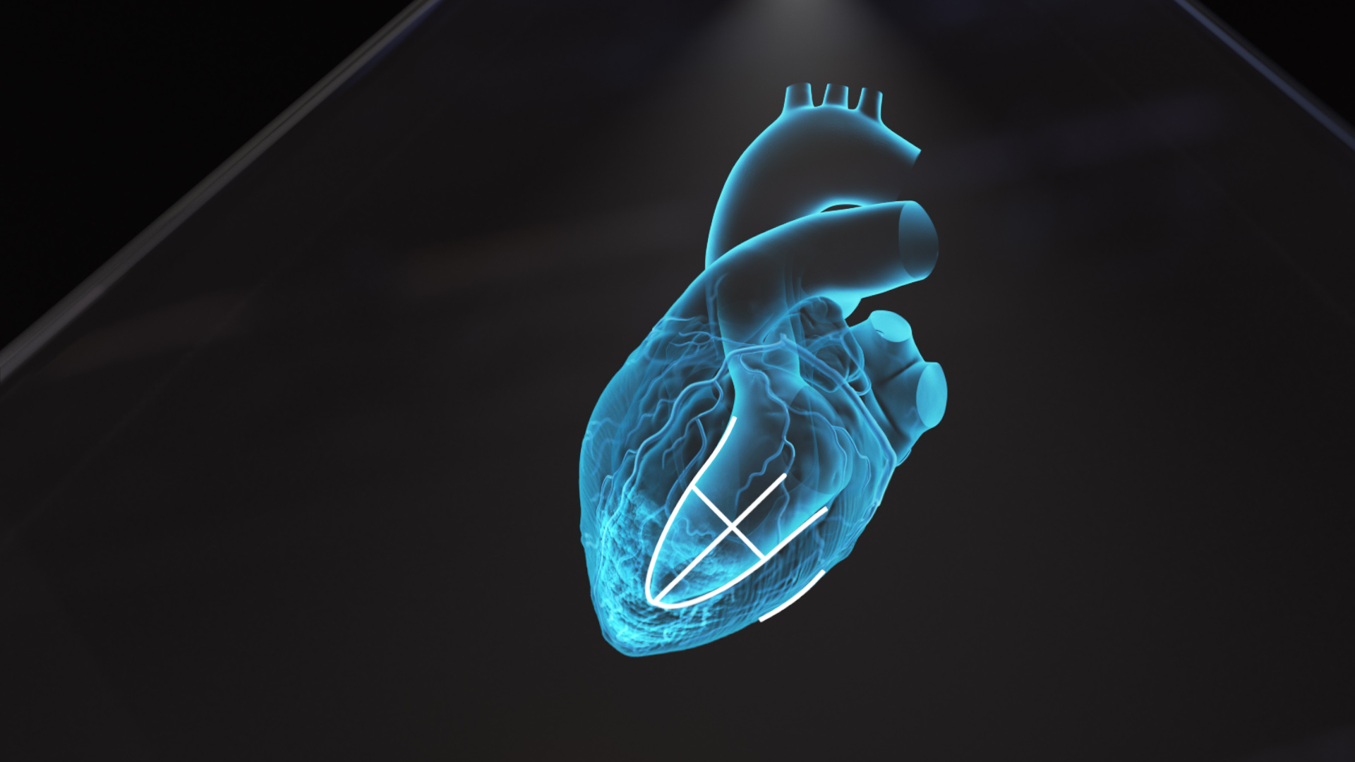 CVD Explorer interactive Hologram | Medical Animation | Scientific ...