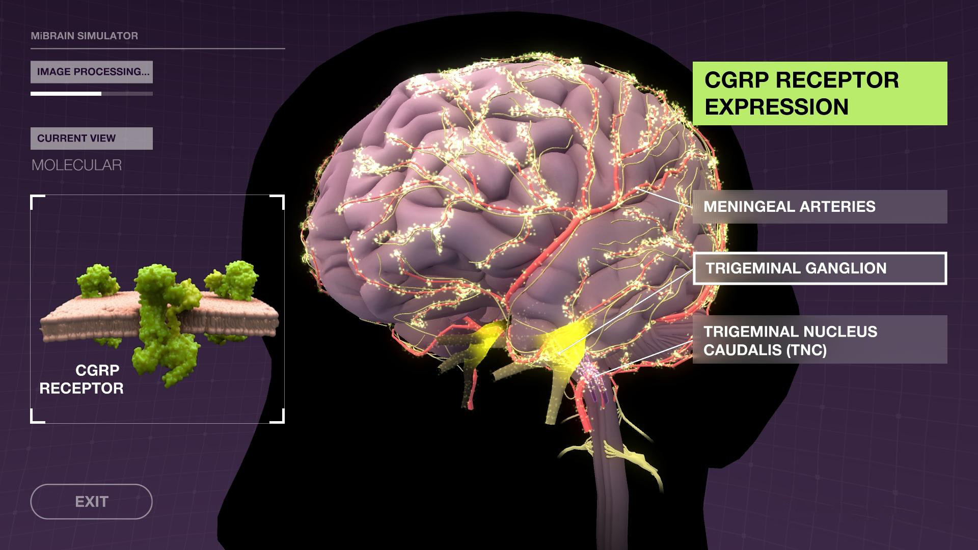 Medical AR: Interactive Migraine Simulator - Medical Animation ...
