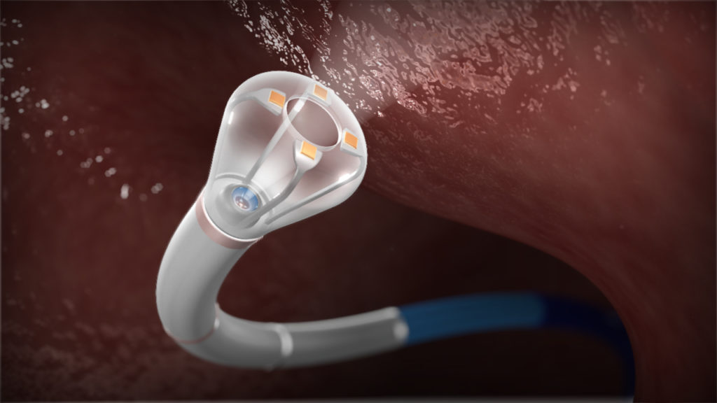 Medical Device Animation | AXS Studio