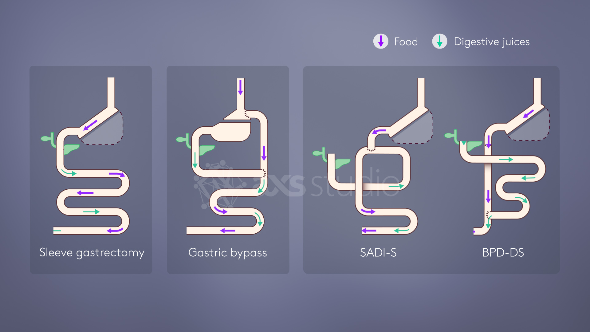 Medical Device Animation: Robotic-Assisted Surgery - AXS Studio